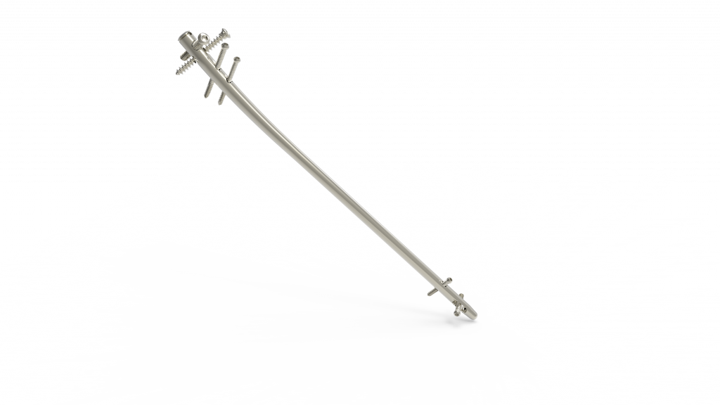 Polarus Plus Humeral Rod | Acumed