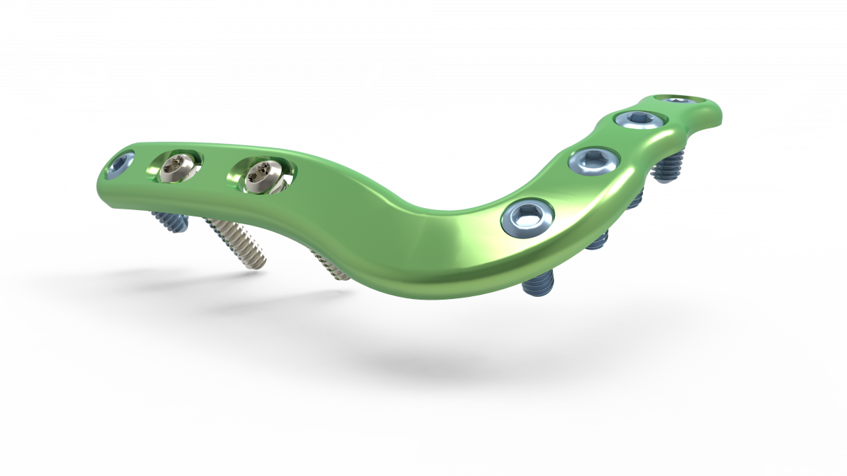 Acromion Plate | Acumed