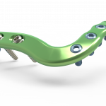 Scapula Plating System | Acumed