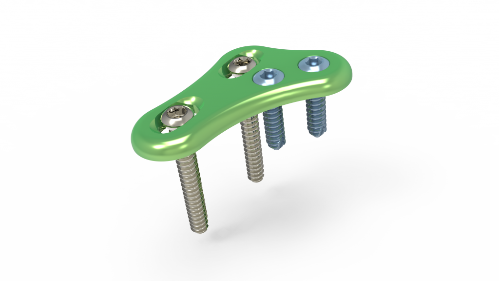 Scapula Plating System | Acumed