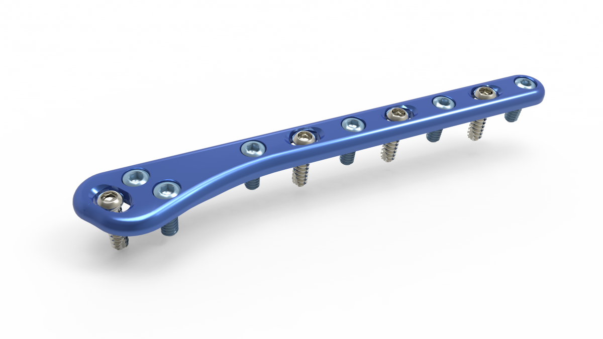 Lateral Border Plate | Acumed