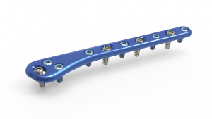 Scapula Plating System | Acumed