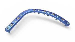 Scapula Plating System | Acumed