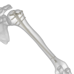 Polarus Humeral Rod System | Acumed