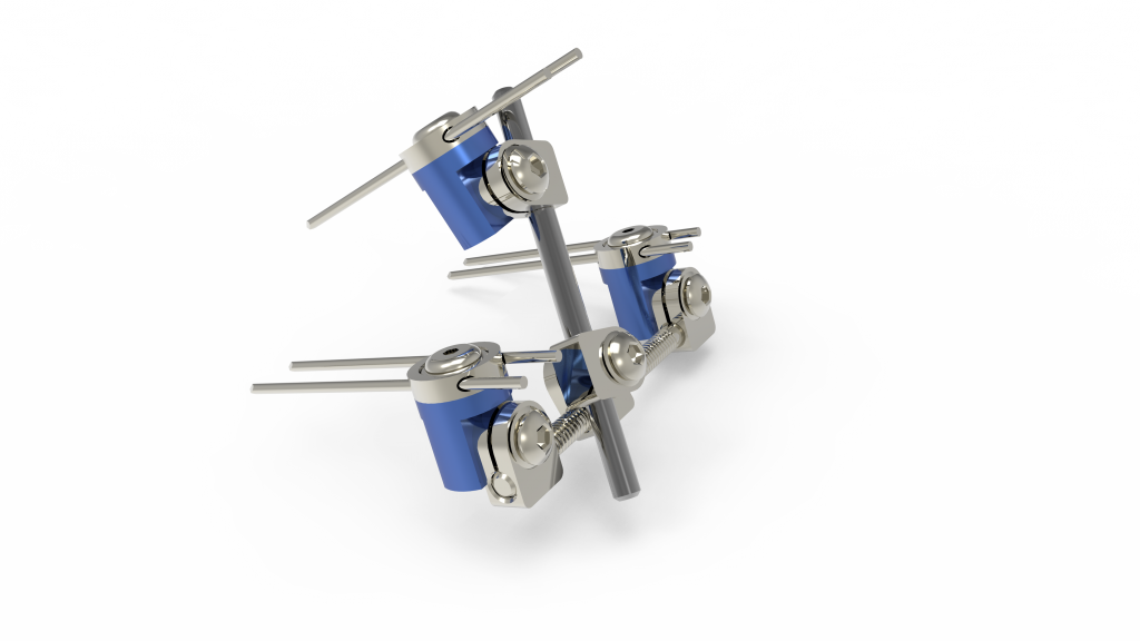 External Fixation System | Acumed