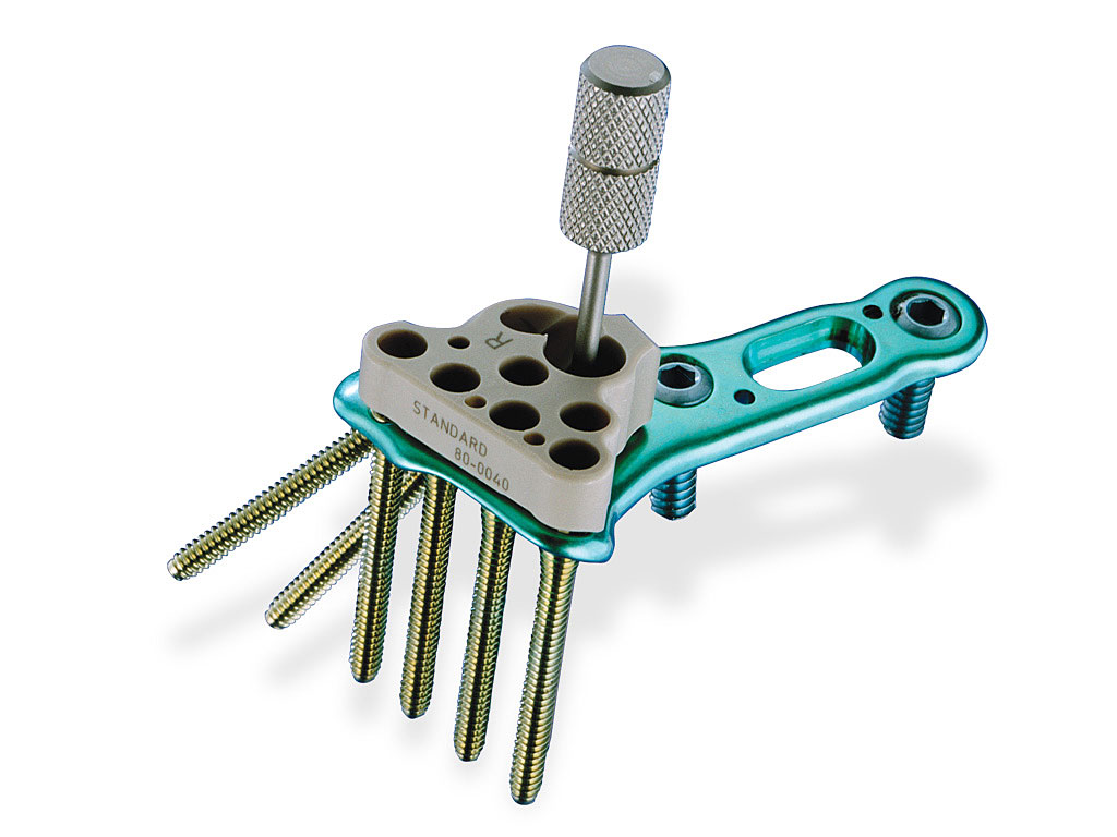 Acu-Loc Wrist Plating System | Acumed