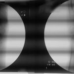 Total Wrist Fusion Plating System | Acumed