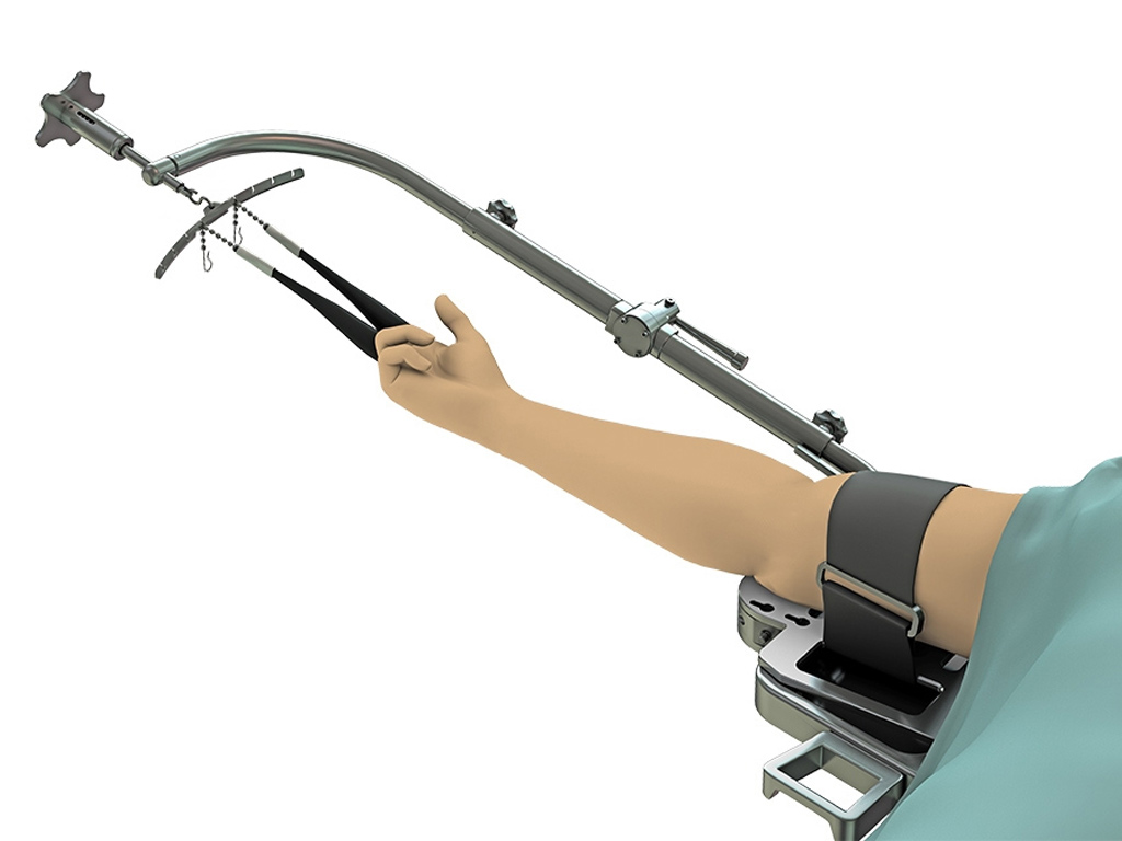 Arc Wrist Tower | Acumed