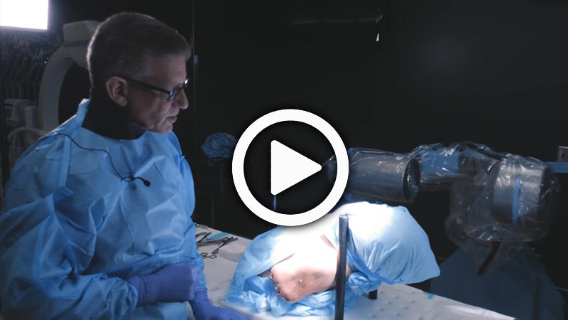 Humeral Plating with Kenneth Koval, MD | Acumed