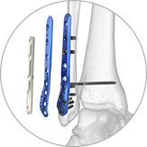 Acumed | Innovation With Purpose