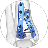 Acumed | Innovation With Purpose