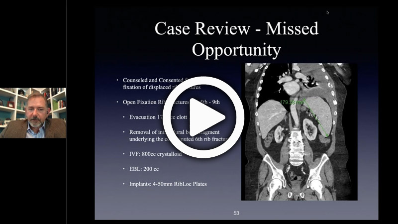 PRO Series: Surgical Stabilization of Rib Fractures with William D ...
