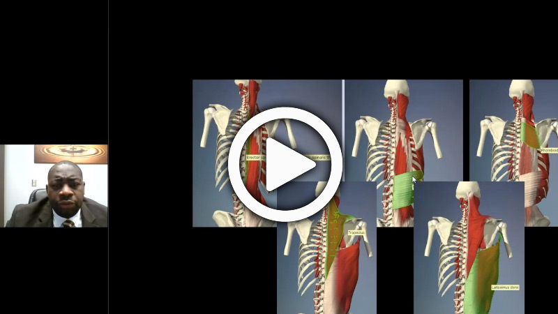 PRO Series: Thoracic Anatomy and Considerations in Operative Rib ...