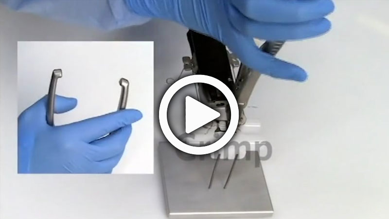 AcuTie II Sternum Closure System Surgical Lab and Technique Overview ...