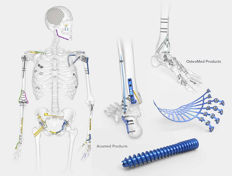 Acumed | Innovation With Purpose