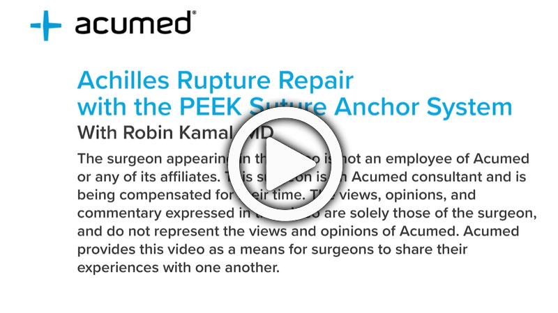 Achilles Rupture Repair with the PEEK Suture Anchor System with Robin ...