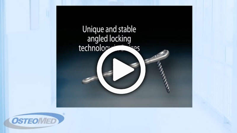 OsteoMed Hand Plating System: Fracture Fixation with Hybrid Plates | Acumed