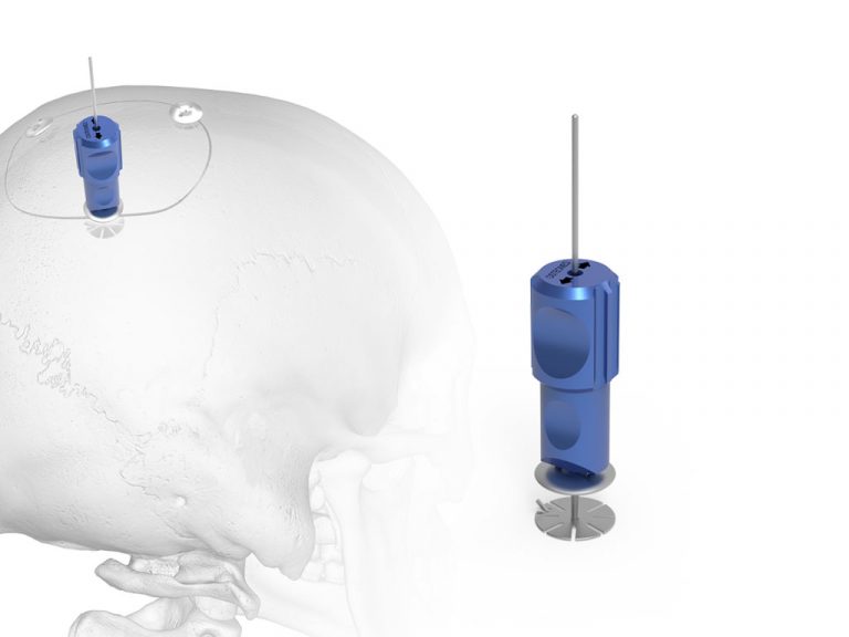 OsteoFlap Cranial Clamp System | Acumed