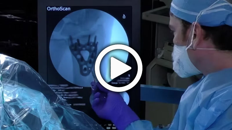 Distal Radius Fracture Fixation Using the Short VDR Plate with Jonathan ...