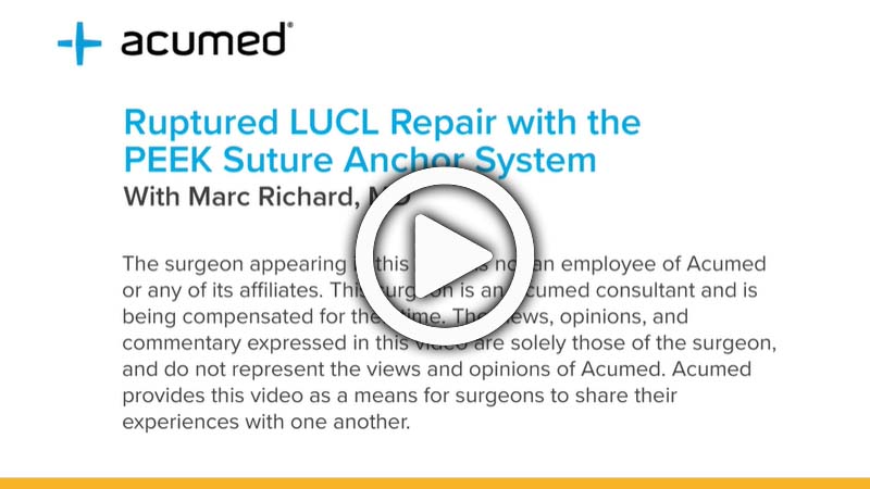 Ruptured LUCL Repair Using the PEEK Suture Anchor System with Marc ...