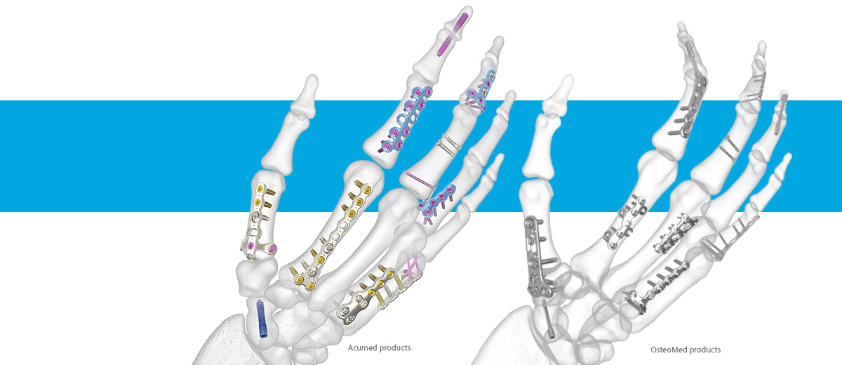 Acumed | Innovation With Purpose