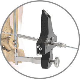 Acumed | Surgical Orthopedic Fracture Fixation Solutions