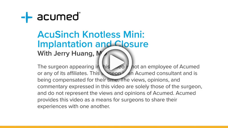 Acu-Sinch Knotless Mini Part 3: Implantation and Closure | Acumed