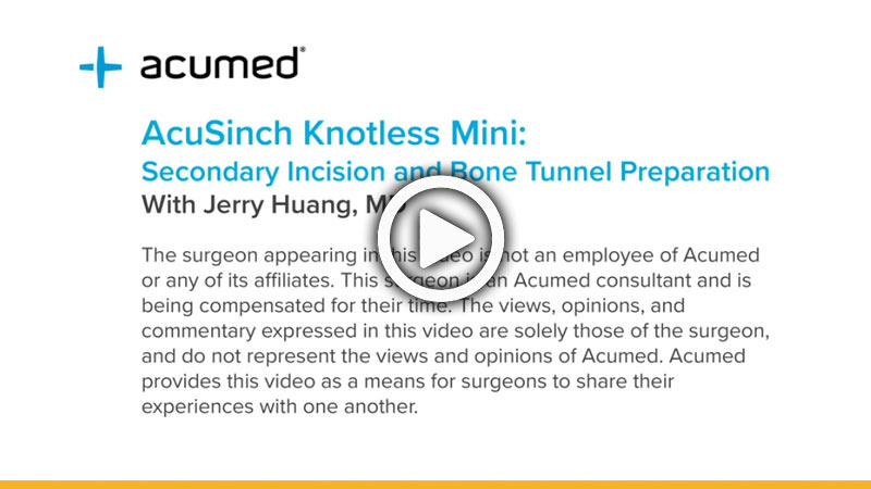 Acu-Sinch Knotless Mini System | Acumed